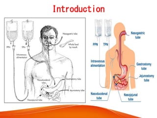 Total Enteral Nutrition