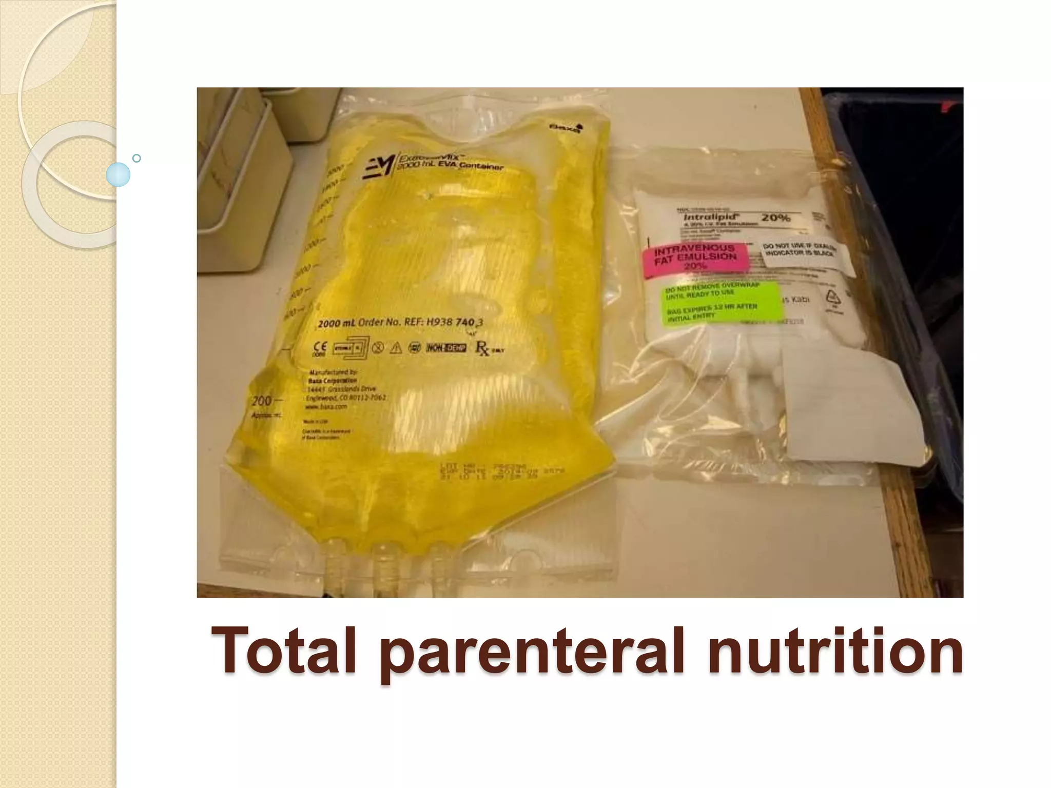 Total parentral nutrition | PPTX