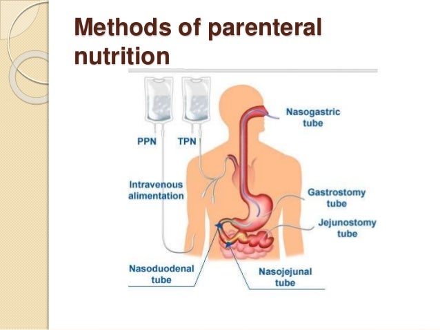 SOLUTION: Total parenteral nutrition - Studypool