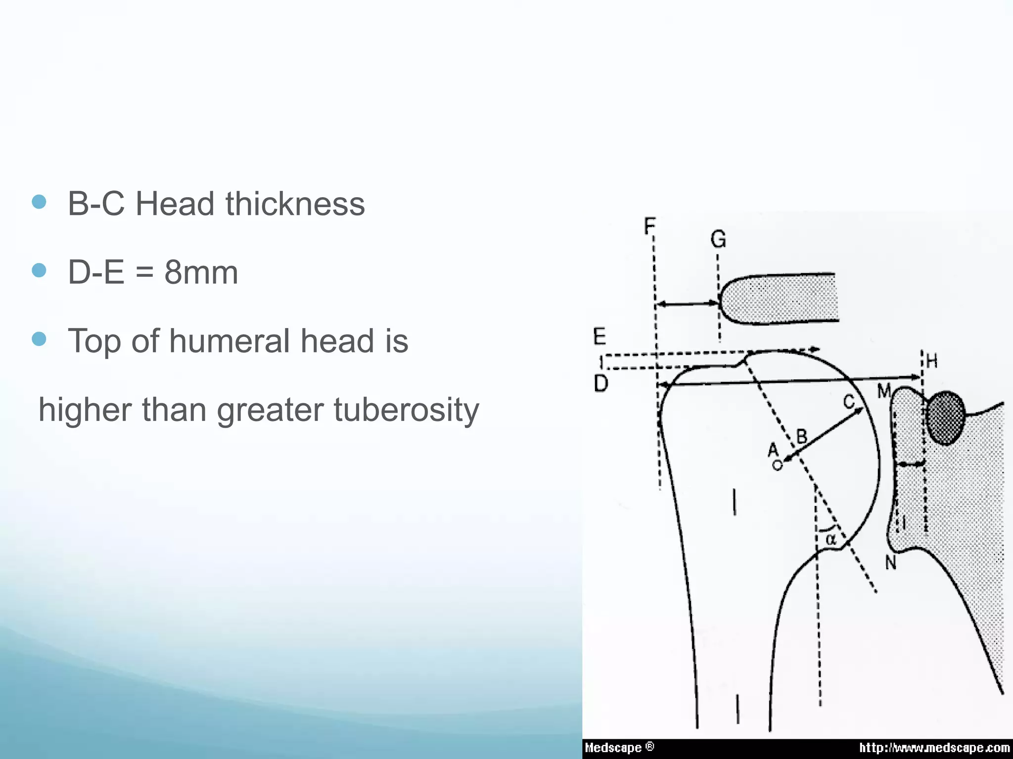 Total shoulder arthroplasty and reverse TSA - Hussain Algawahmed | PPTX