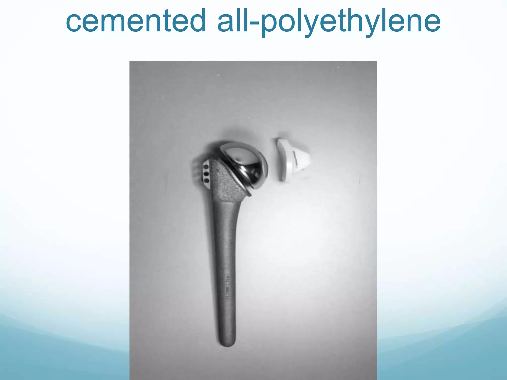 Total shoulder arthroplasty and reverse TSA - Hussain Algawahmed | PPTX