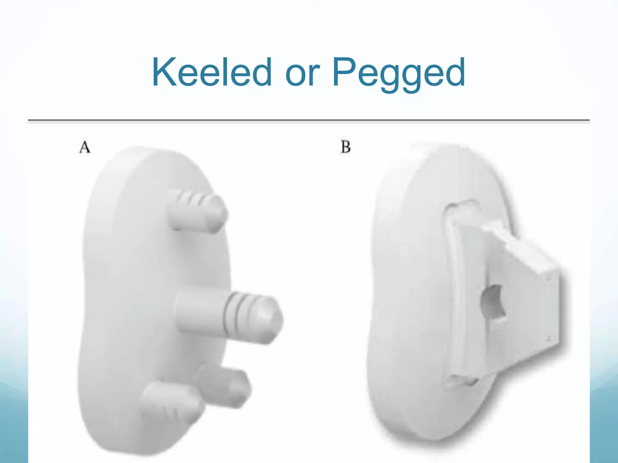 Total shoulder arthroplasty and reverse TSA - Hussain Algawahmed | PPTX