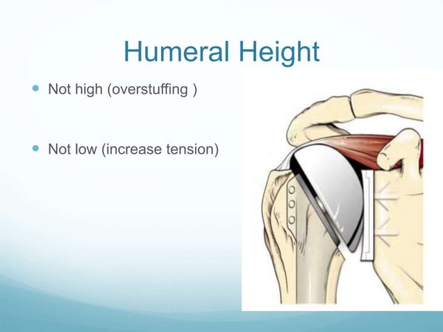 Total shoulder arthroplasty and reverse TSA - Hussain Algawahmed | PPTX