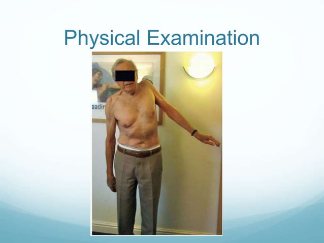 Total shoulder arthroplasty and reverse TSA - Hussain Algawahmed | PPTX