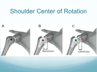 Total shoulder arthroplasty and reverse TSA - Hussain Algawahmed | PPTX