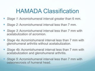 Total shoulder arthroplasty and reverse TSA - Hussain Algawahmed | PPT