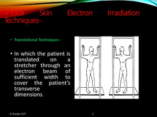 Total skin electron irradiation | PPTX