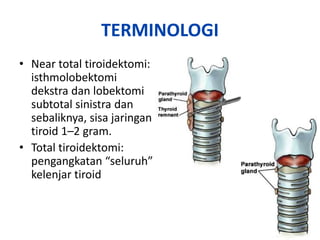 tehnik operasi tiroidektomi | PPT