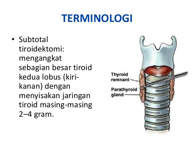 tehnik operasi tiroidektomi