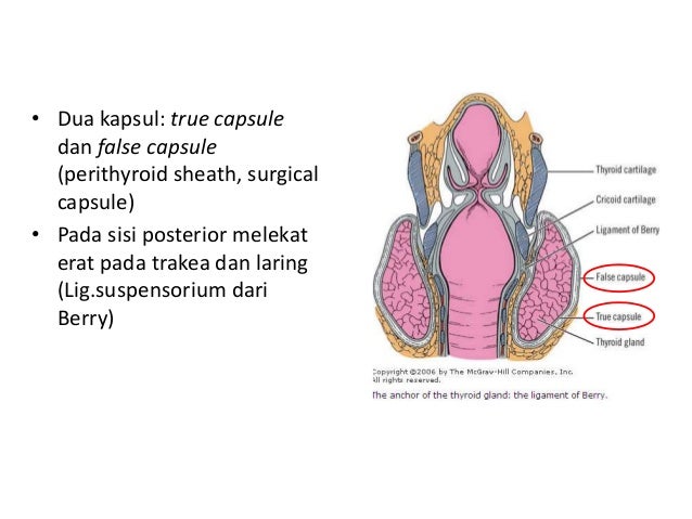 tehnik operasi tiroidektomi