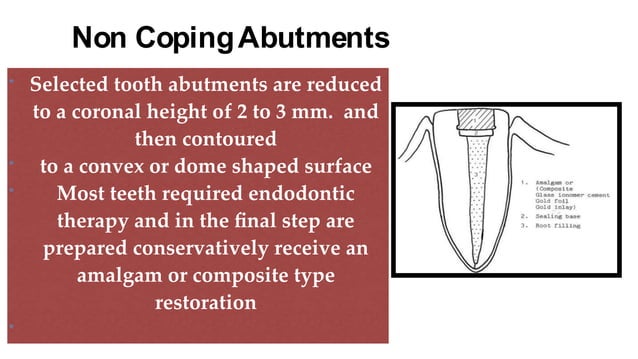 Totth supported overdenture (part 1) | PPTX | Dental Health | Diseases ...