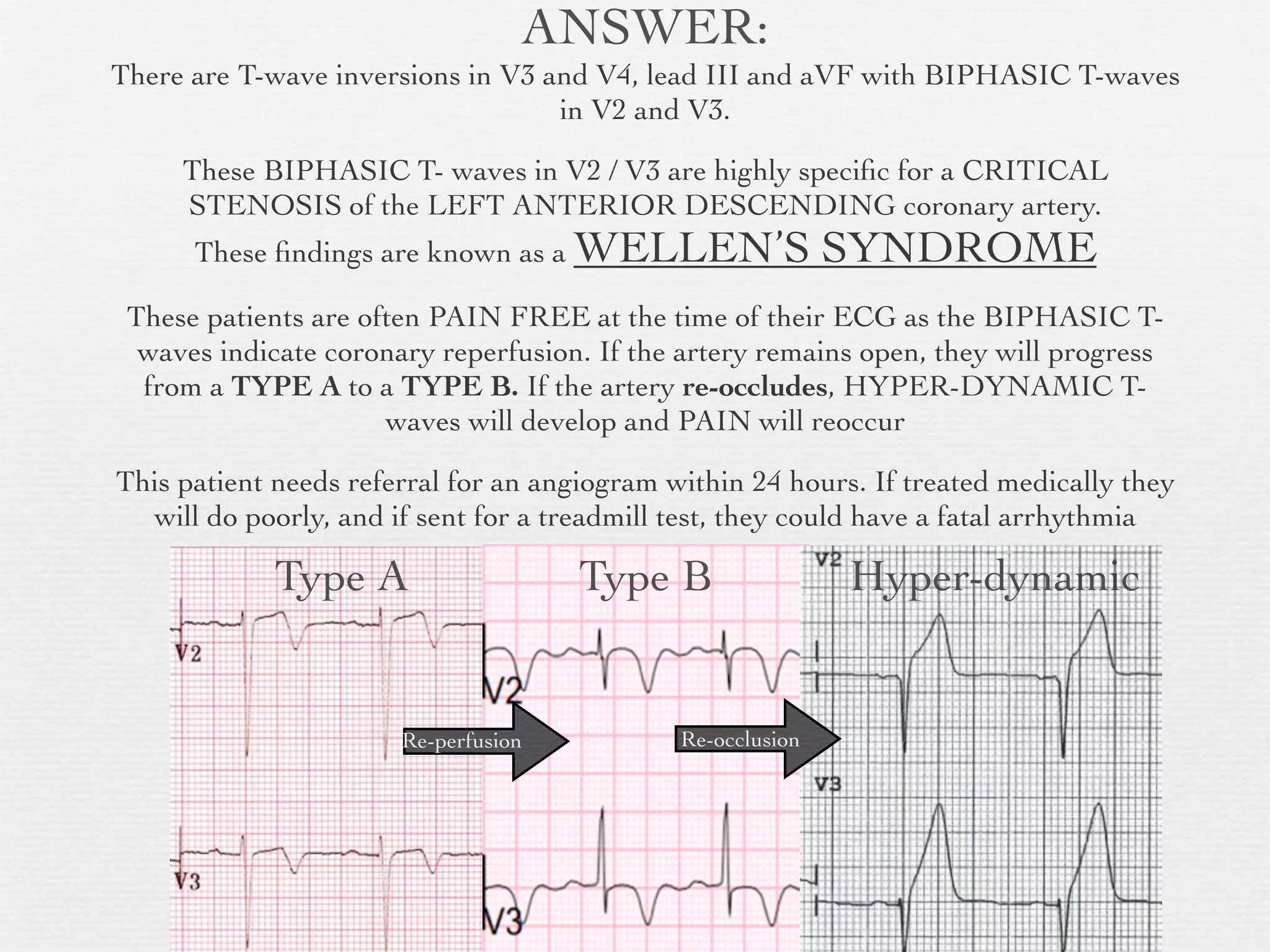 ECG Quiz | PDF