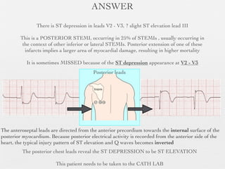 ECG Quiz | PDF