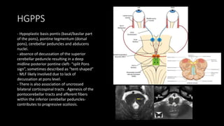 Mobius syndrome and HGPSS | PPT