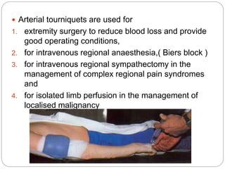 TOURNIQUET AND ITS EFFECTS | PPTX