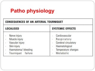 TOURNIQUET AND ITS EFFECTS | PPTX