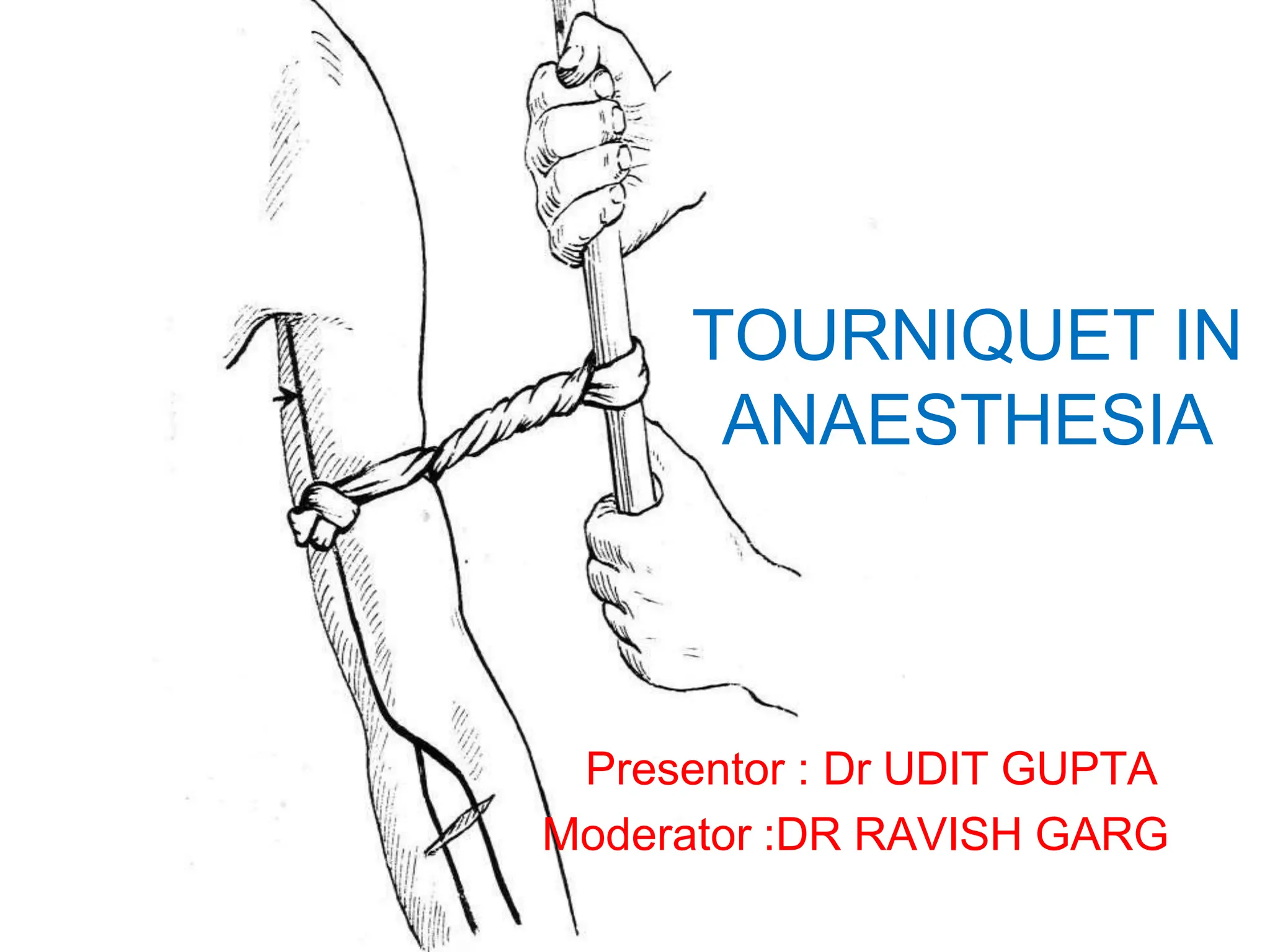 tourniquet 150602065735-lva1-app6891 (1).pptx