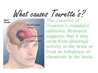 Tourette’s | PPT | Brain and Nervous System Disorders | Diseases and ...