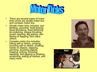 Tourette syndrome | PPT