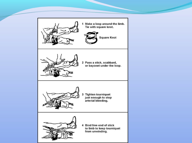 Tourniquet | PPT