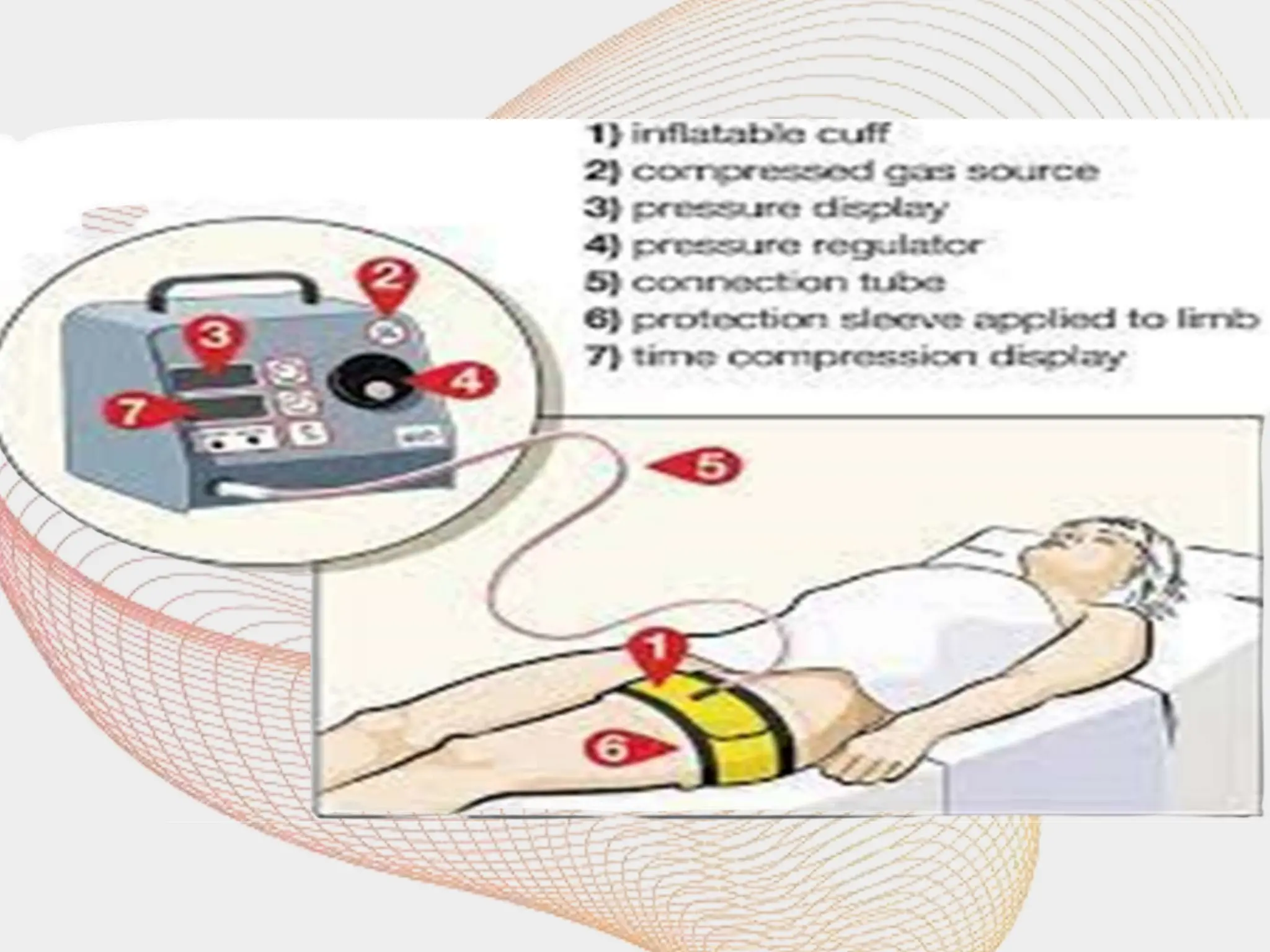 TOURNIQUET IN SURGERY BY DR. OREVA-OGHENE.pptx