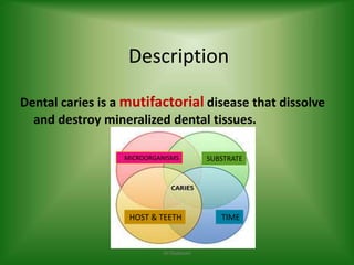 Dental Caries | PPT