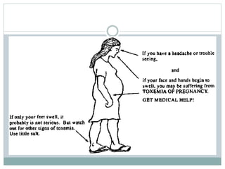 Toxemia in-pregnancy | PPTX