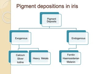 Toxic Deposits in iris.pptx