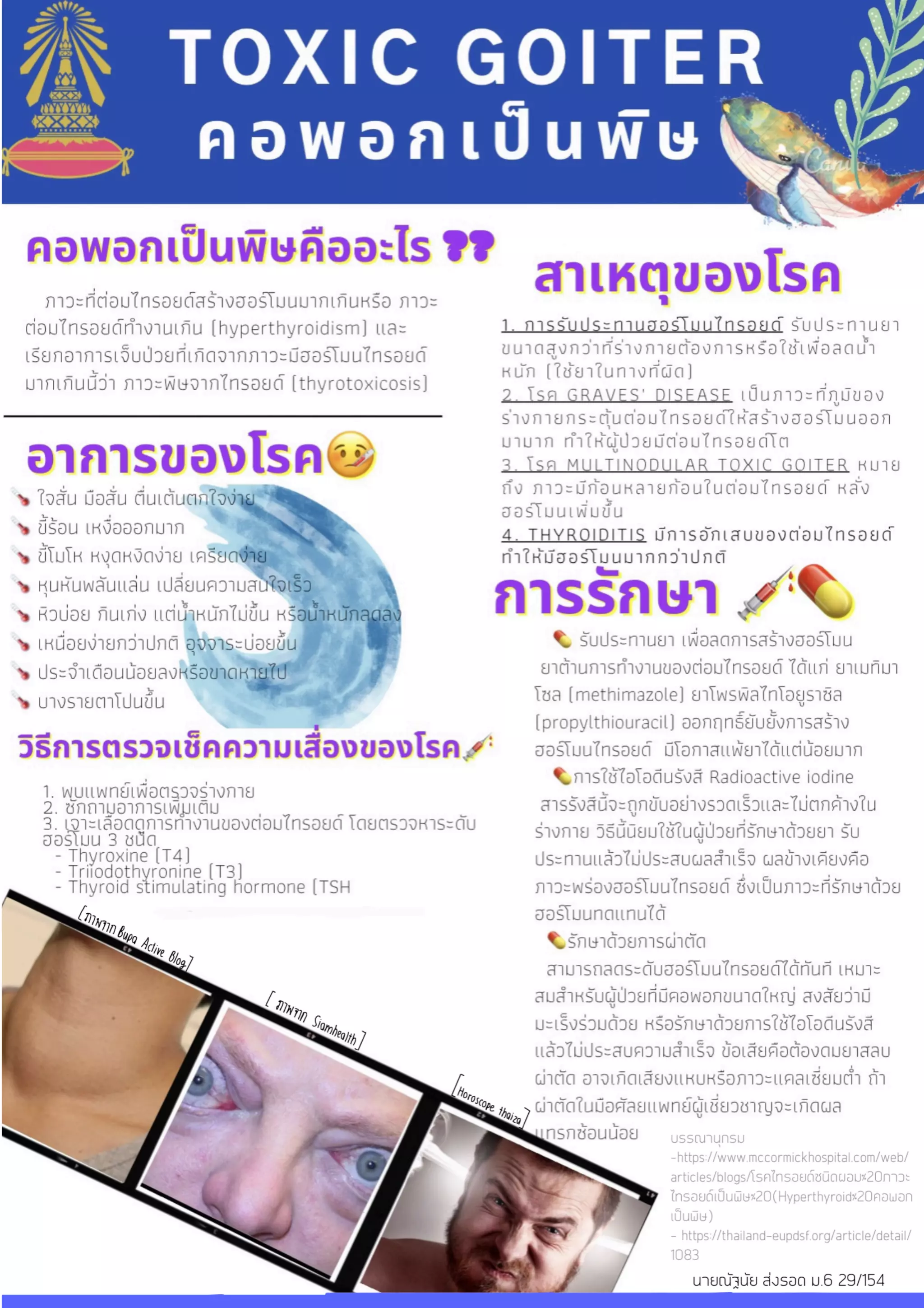 Toxic goiter | PDF