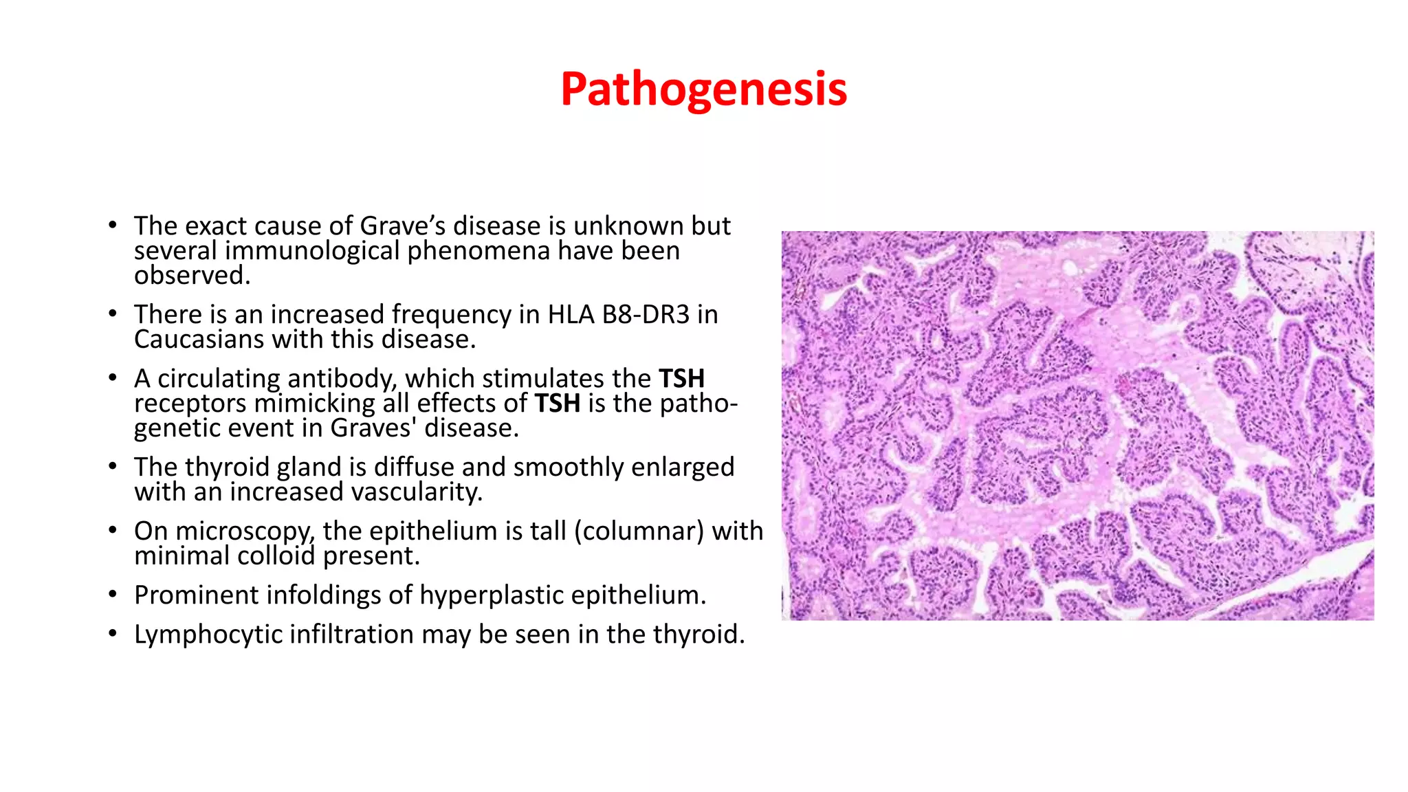 Thyrotoxicosis | PPTX