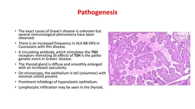 Thyrotoxicosis | PPTX