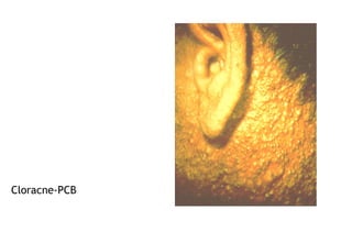TOXICOLOGIA 2024 principales riesgos de quimicos | PPT