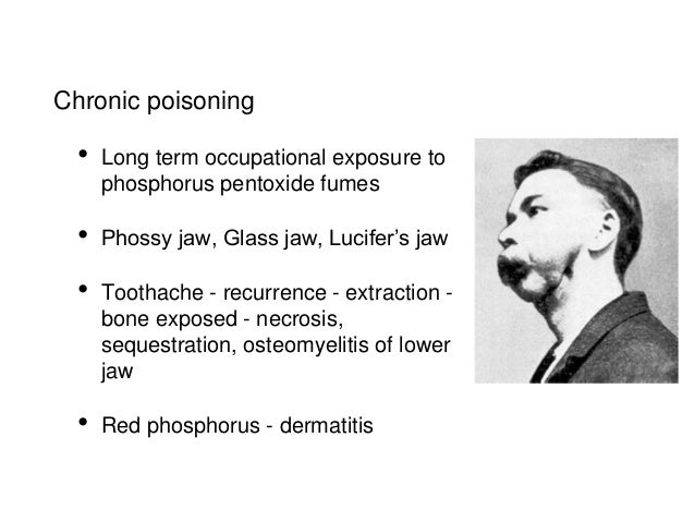 Toxicology - Phosphorus Poisoning