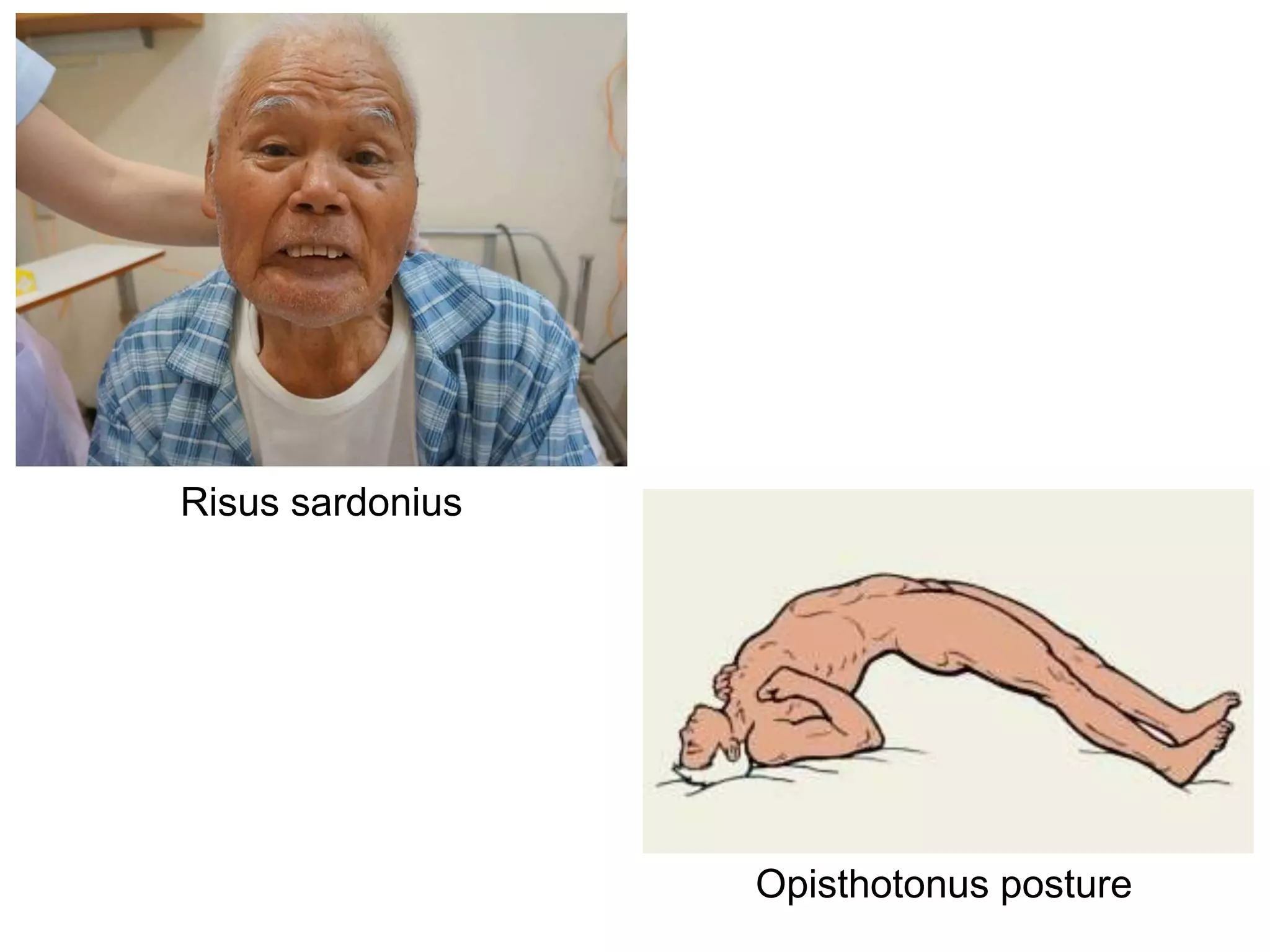 Toxicology - Strychnine / strychnos nux-vomica poisoning | PPTX