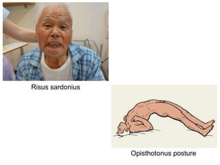 Toxicology - Strychnine / strychnos nux-vomica poisoning | PPTX