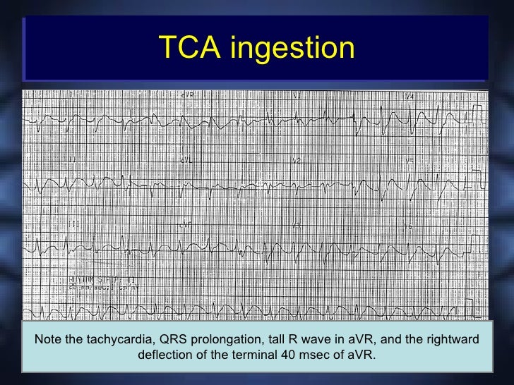 Toxicology Emergencies CDEM