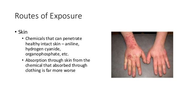 Introduction to Toxicology