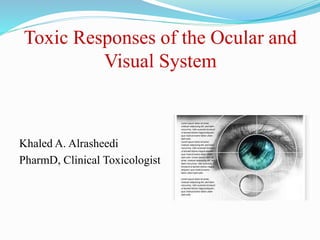 Toxic responses of the ocular and visual system | PPT