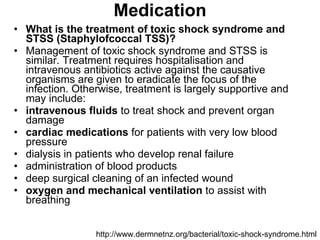 Toxic Shock Syndrome | PPT