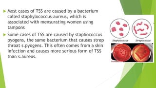 toxic shock syndrome.pptx