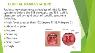 toxic shock syndrome.pptx