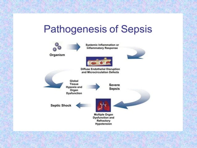 TOXIC SHOCK SYNDROME - PATHOPHYSIOLOGY TREATMENT AND PREVENTION | PPT