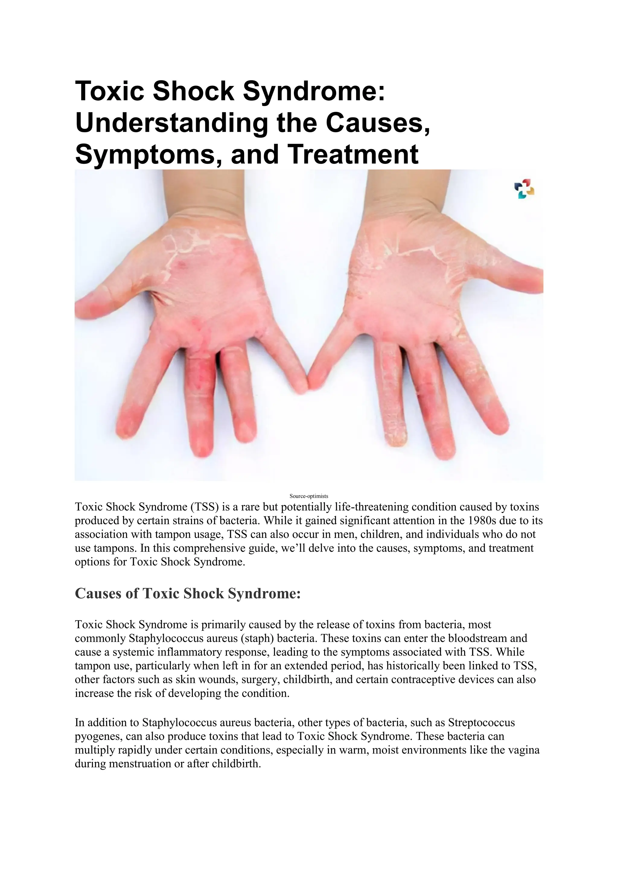 Toxic Shock Syndrome: Causes, Symptoms, and Treatment | The ...