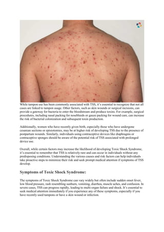 Toxic Shock Syndrome: Causes, Symptoms, and Treatment | The ...