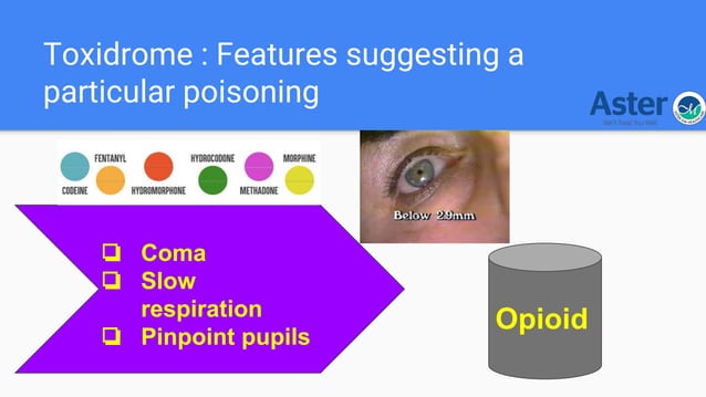 Toxidrome approach in emergency room | PDF | Illegal Drugs, Tobacco ...