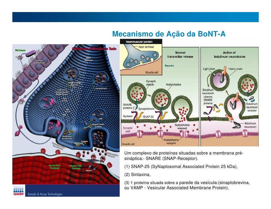 Toxina Botulinica BoNT-A Portugues ABR10
