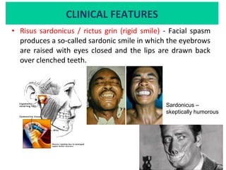 Toxins of Clostridium tetani | PPT