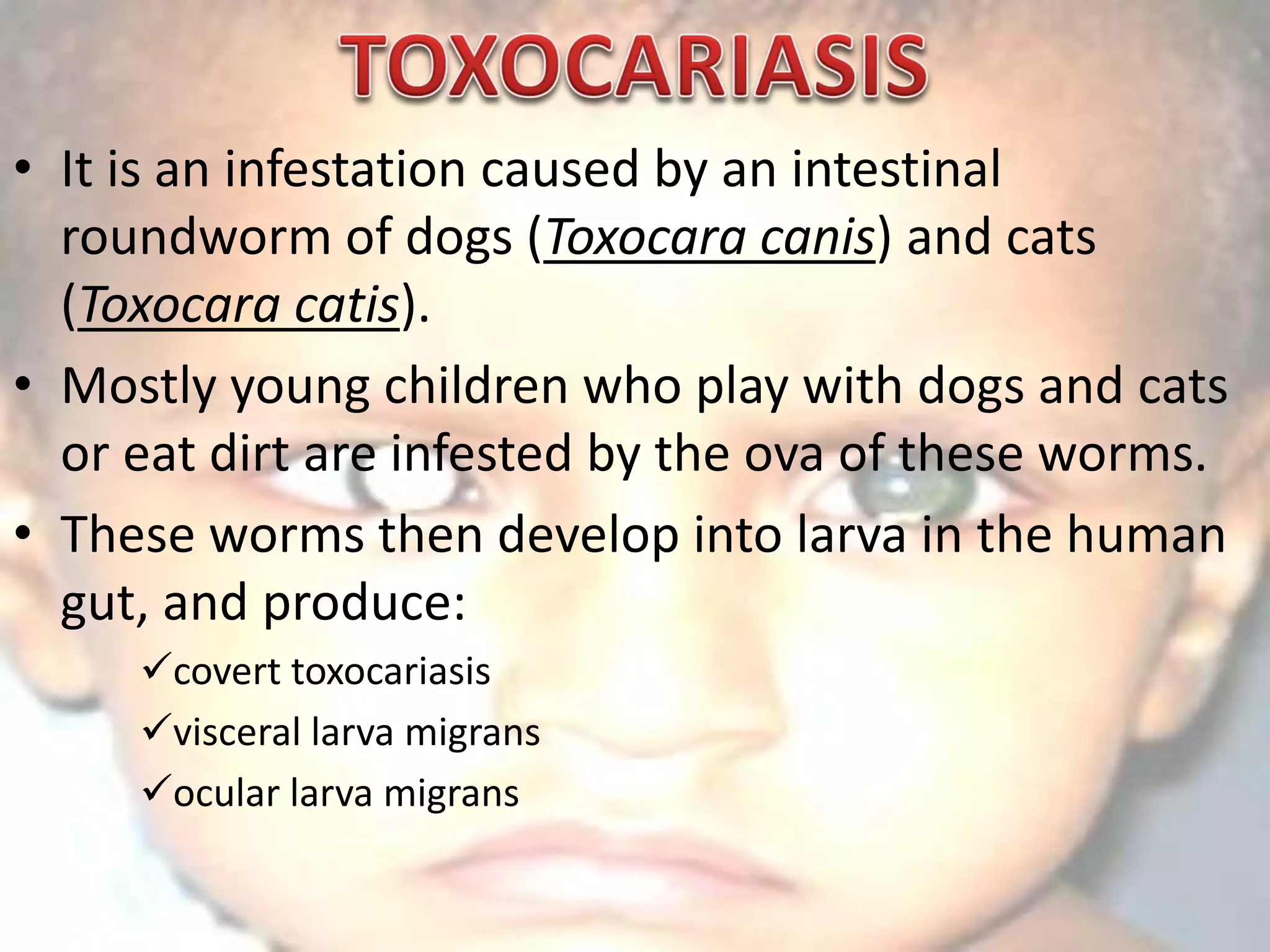 Toxocariasis | PDF