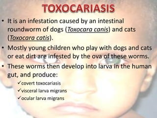 Toxocariasis | PPT