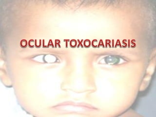 Toxocariasis | PDF